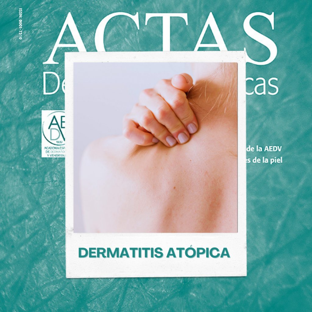 Nueva publicación científica: Dermatitis Atópica - Dra. Monica Munera ...